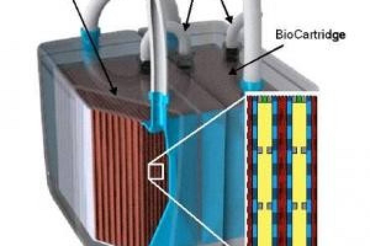 Científicos desarrollan el primer prototipo de riñón artificial implantable Científicos desarrollan el primer prototipo de riñón artificial implantable