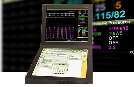 Análisis de antivirus interrumpió un procedimiento cardíaco