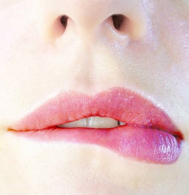 S.O.S para los labios resecos - Belelú | Nueva Mujer