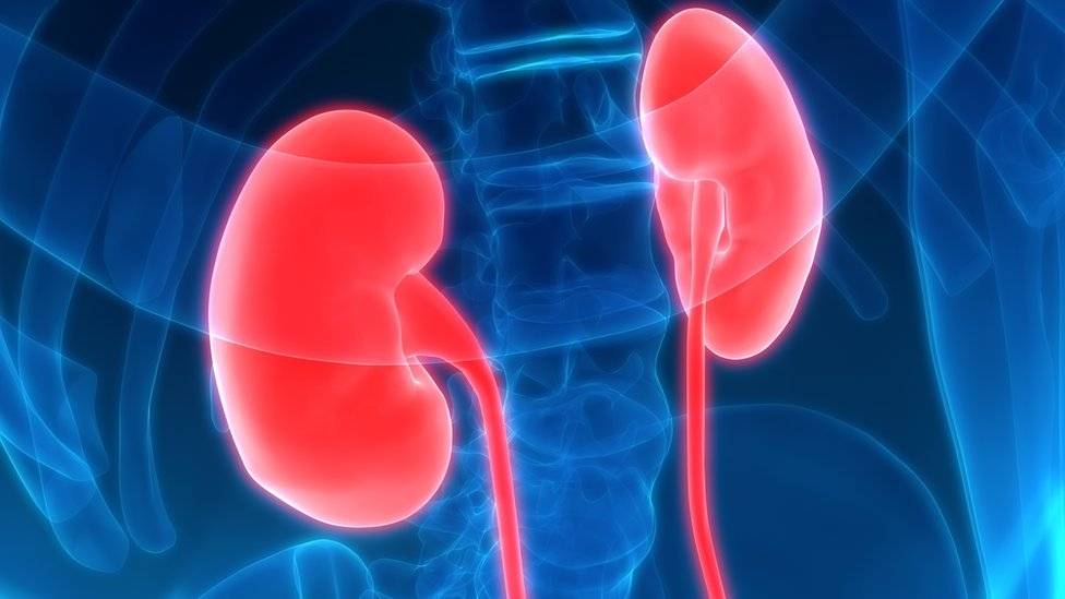 El raro caso del riñón que fue trasplantado dos veces a dos receptores ...