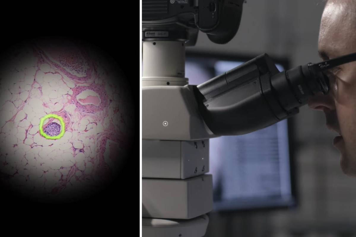 Video: Google presenta impresionante microscopio capaz de detectar el ...